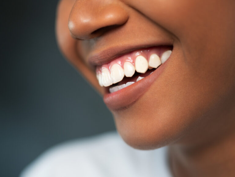 Cosmetic Dentistry – Welcome to Visonary Smiles